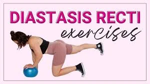 9 Best Home Exercises for Diastasis Recti - Home Physio